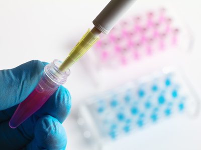 Blutwerte Lexikon > Die wichtigsten Werte einfach erklärt