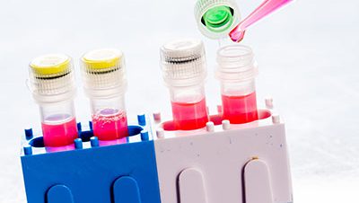 Blutbild: Großes Blutbild - Werte der Blutuntersuchung