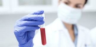 Alle einzelnen Blutwerte und Laborwerte verständlich erklärt