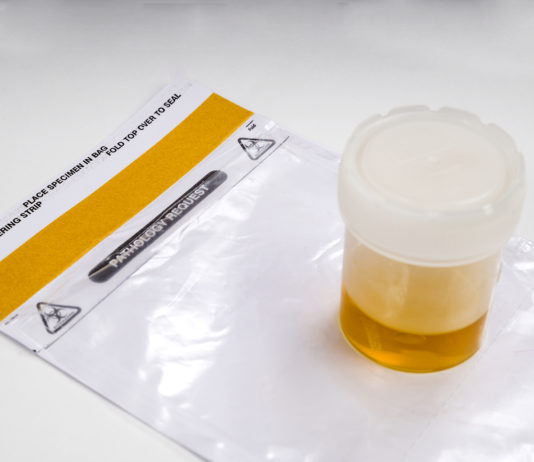 Urinuntersuchungen als Diagnosemethode - Ablauf, Werte und Verfahren: