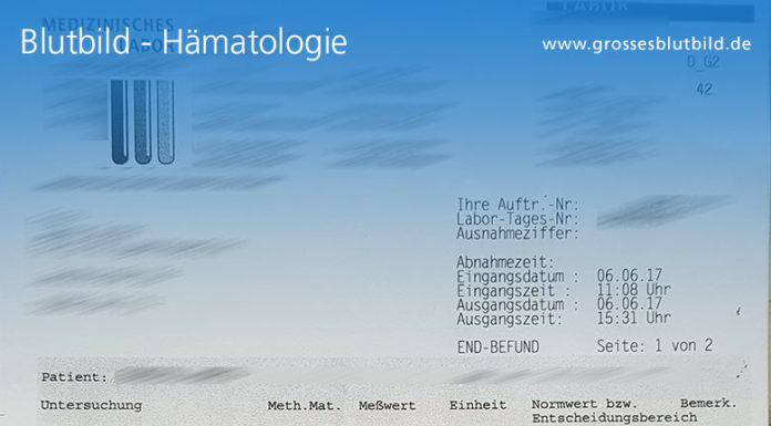 Großes Blutbild - Alle Werte des Hämogramm verständlich erklärt: