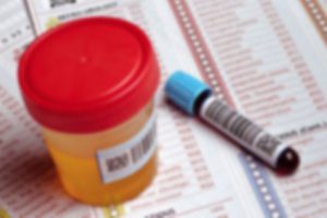 Was wird bei einem Urintest untersucht? Urin-Diagnostik