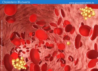 Cholesterinwerte Tabelle - Normalwerte Männer und Frauen » Dr. Stephan